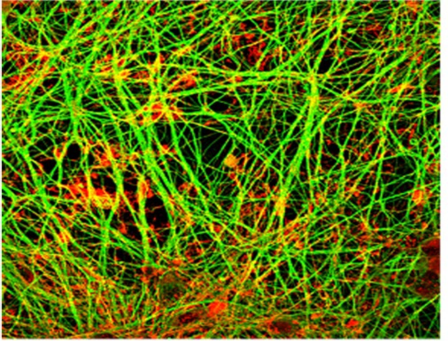 Personalized Synapse Proteomics of living psychiatric patients ...