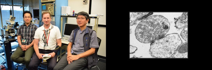 synaptosome_hpi.jpg | Okinawa Institute of Science and Technology OIST