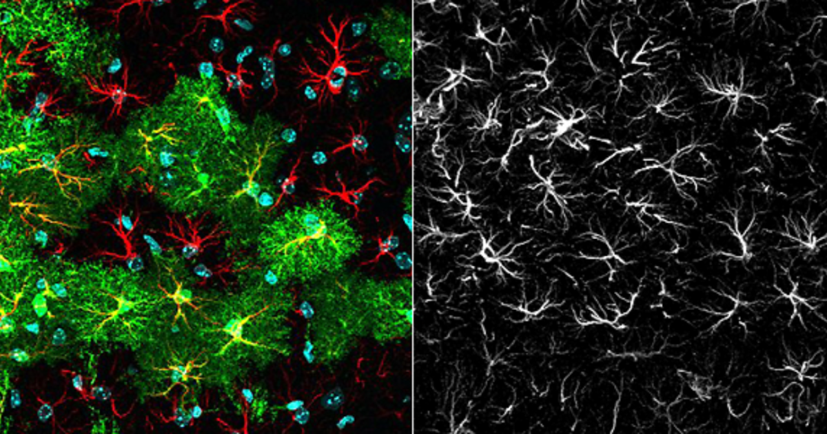 Synapse Biology Unit | Okinawa Institute of Science and Technology OIST