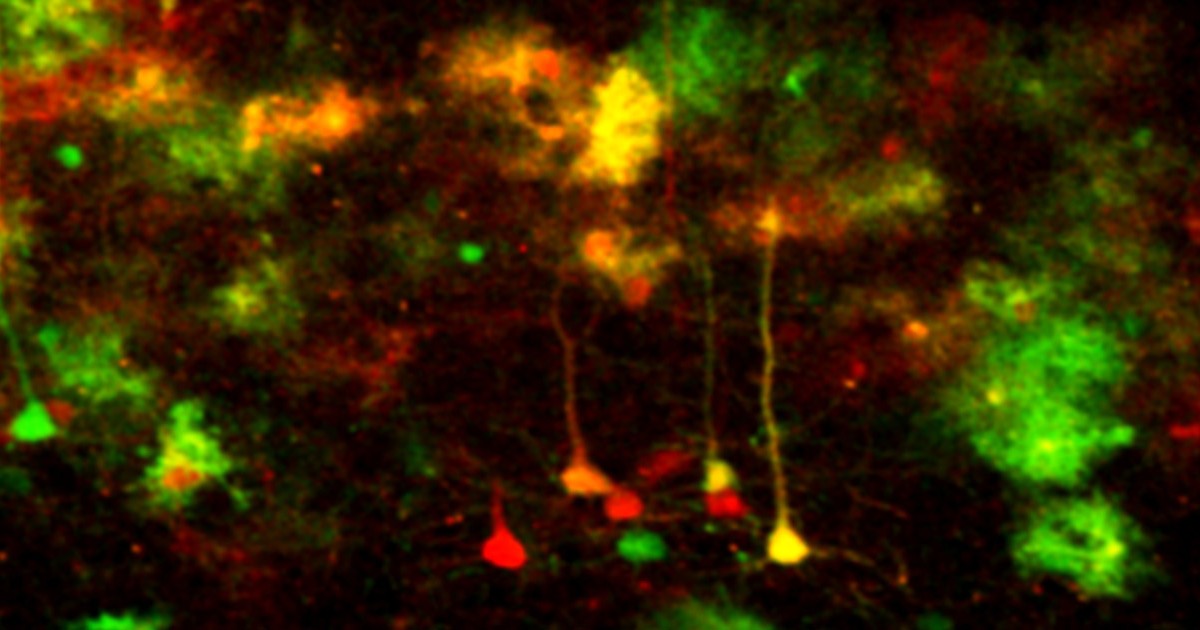 Stargazing in the brain: “Star-like” cells display unique activity ...