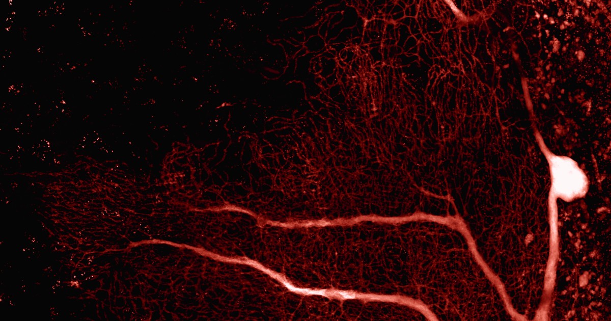 IS23-Double-tree human Purkinje neuron | Okinawa Institute of Science ...