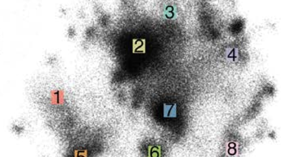 Cuttlefish camouflage skin patterns are categorized in “skin pattern ...