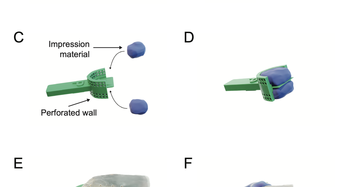 How the dental mold works | Okinawa Institute of Science and Technology ...