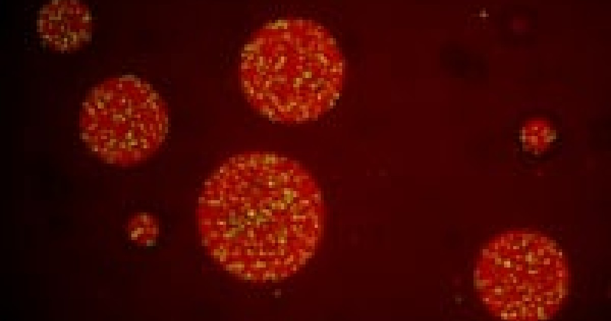 Urease-Rhodamine | Okinawa Institute of Science and Technology OIST