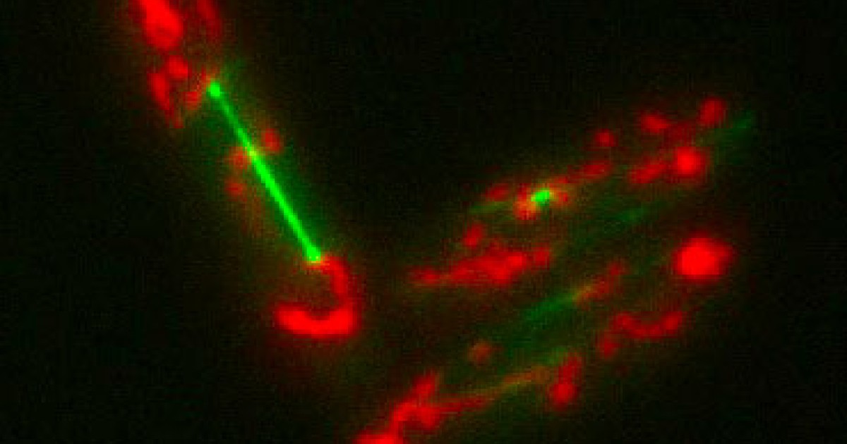 20110513-takeda-yeast_still.jpg | Okinawa Institute of Science and ...