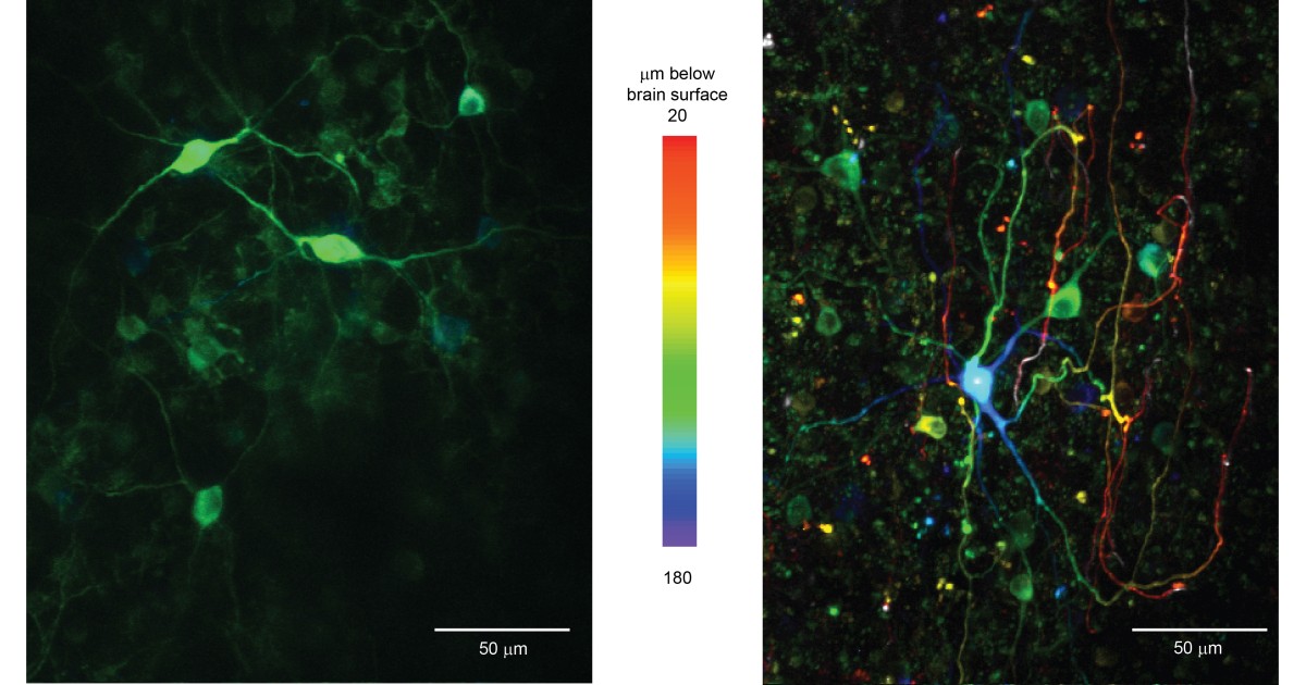 Lugaro cells and a Golgi cell | Okinawa Institute of Science and ...