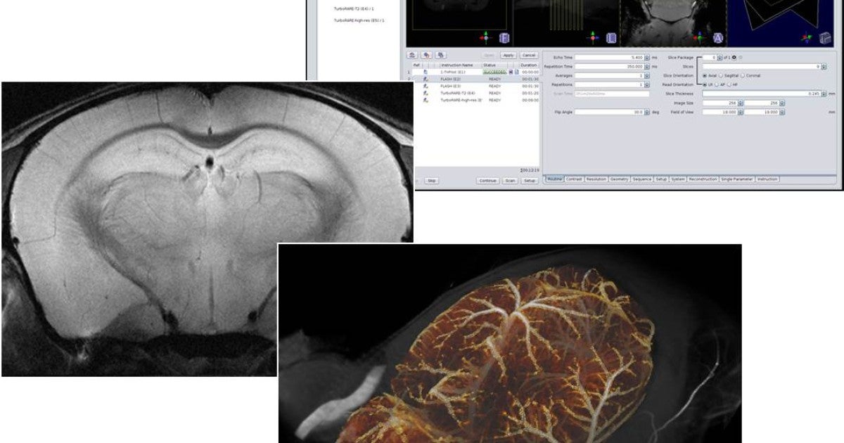 Examples of various types of imaging analysis from the OIST MRI for ...