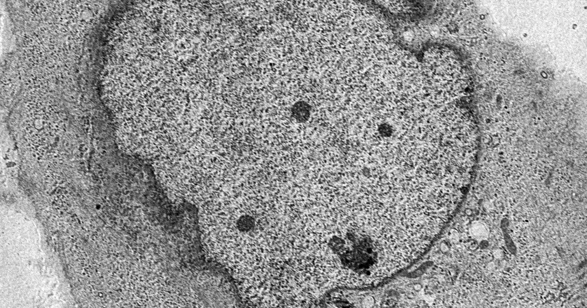 Cell Undergoing Necroptosis | Okinawa Institute of Science and ...