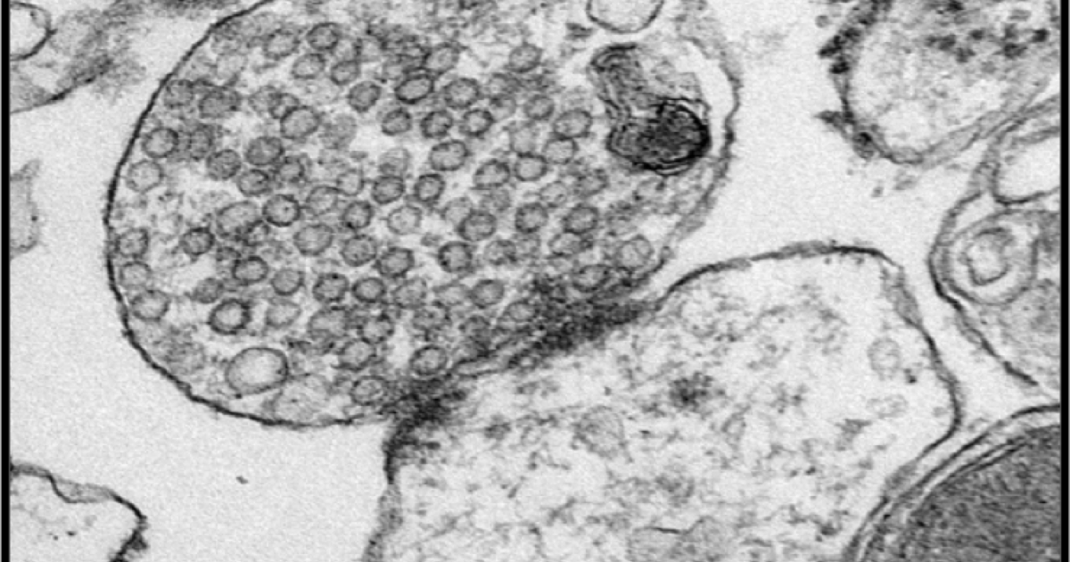 A high magnification image of synapse obtained by electron microscopy | Okinawa Institute of ...